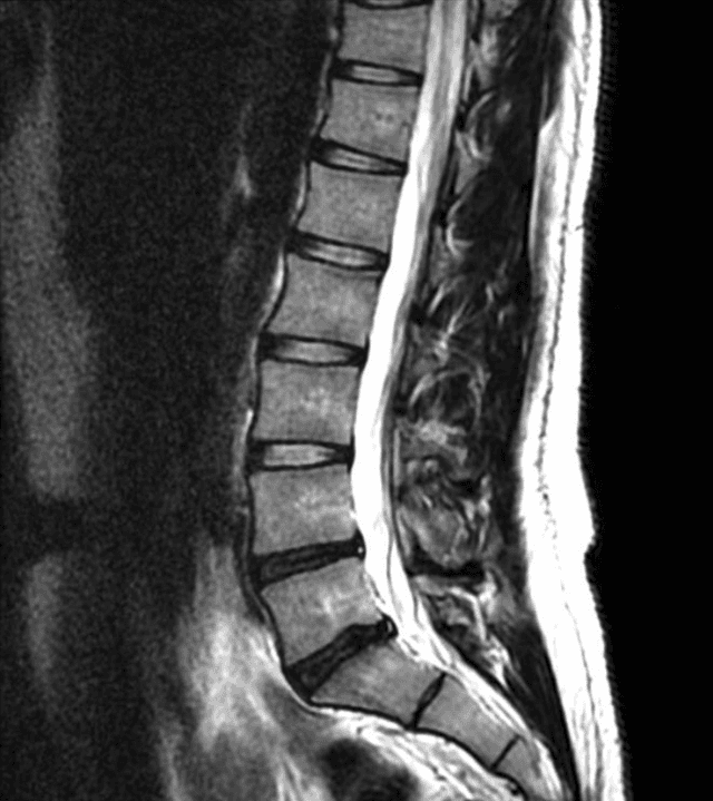 Mountain Spine & Orthopedics | Top Florida Orthopedic & Spine Surgeons