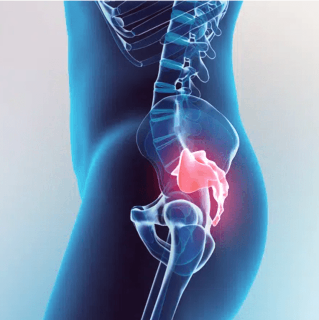 Tailbone Pain (Coccydynia) Relief | Mountain Spine Florida